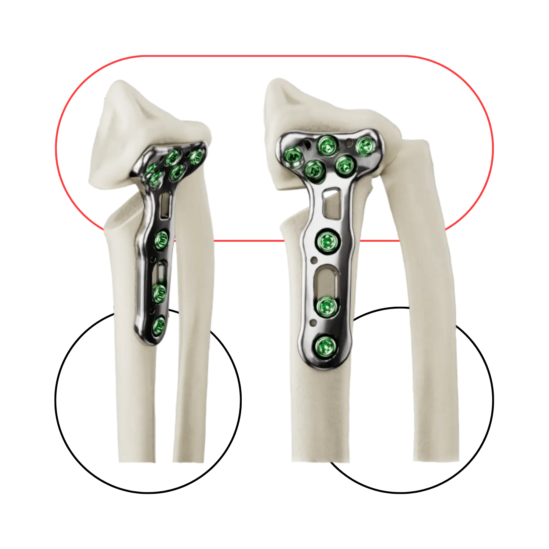 Procedimientos y Soluciones 3D para Cirujanos - Tailor Surgery